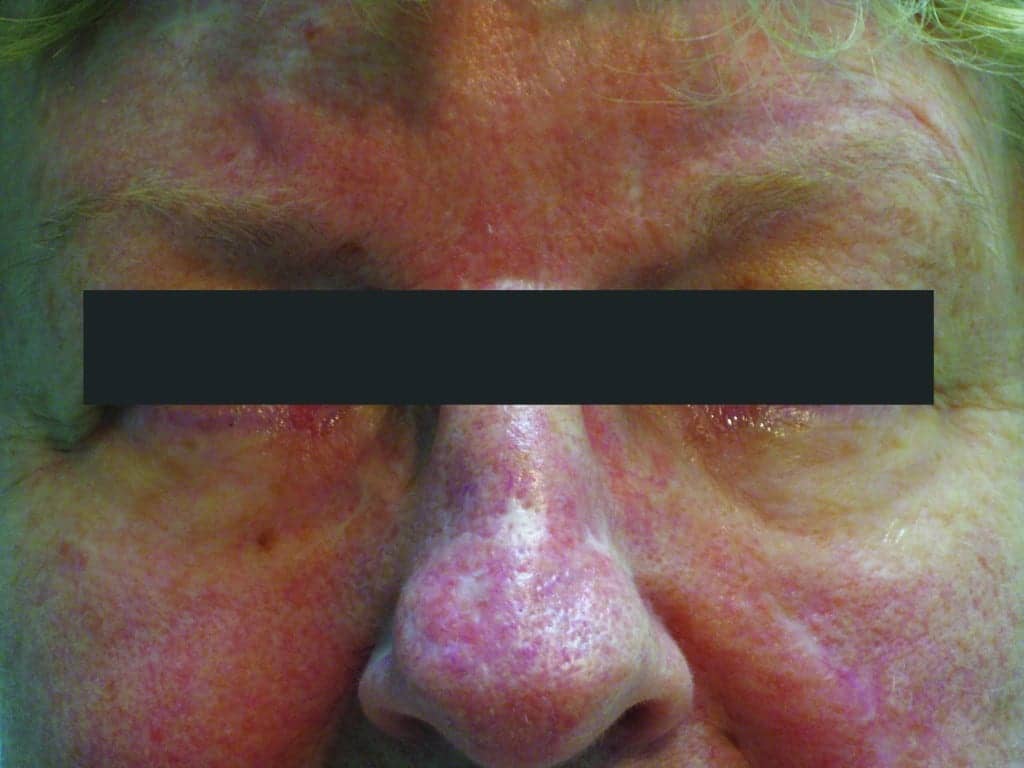 The Eyes: The Eyes Have It - Plastic Surgery Practice