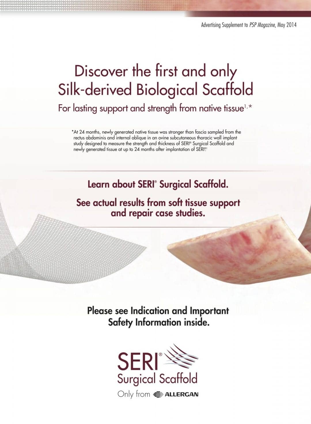 Advertising Supplement: SERI Surgical Scaffold - Plastic Surgery Practice