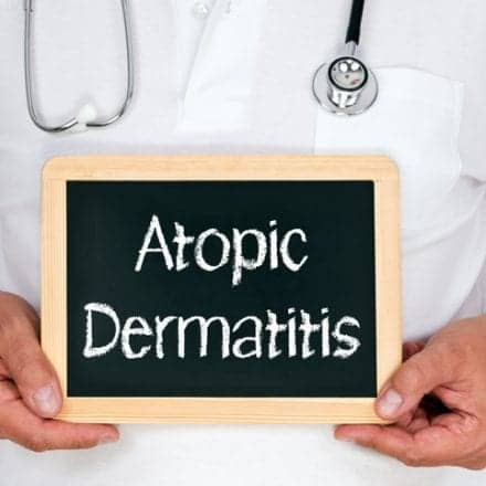New AAD Guidelines Call for Proactive Approach to Atopic Dermatitis ...