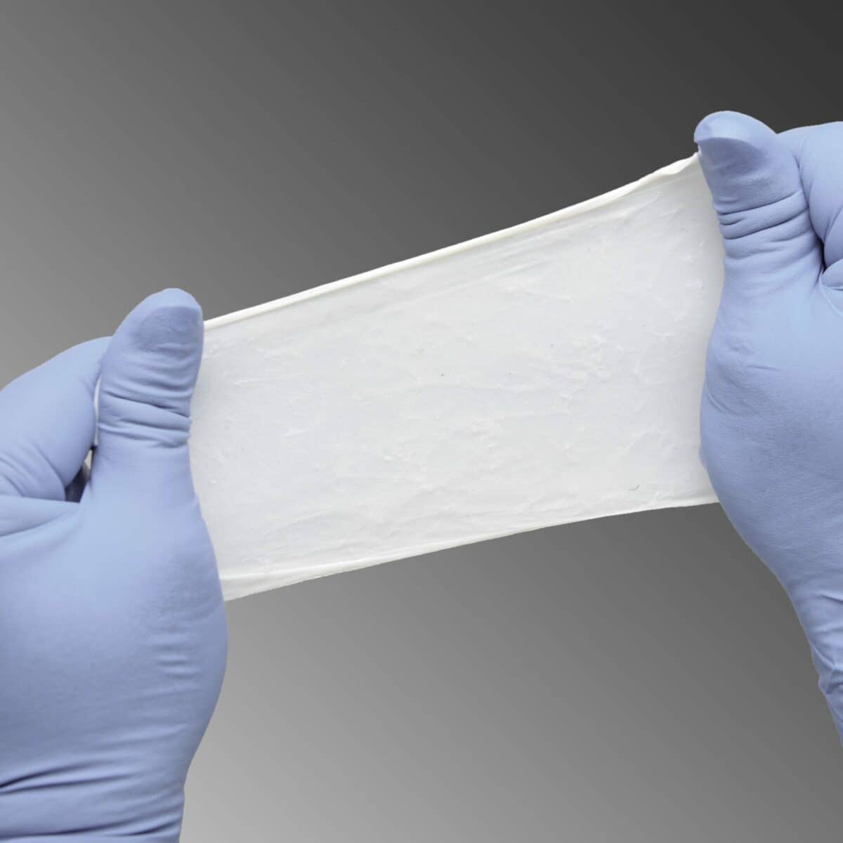 There’s A New Mesh in Town: DSM’s Meso BioMatrix Acellular Peritoneum ...