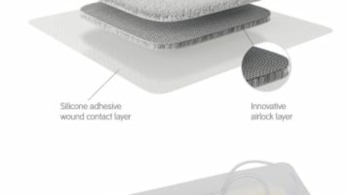 Smith Nephew PICO Negative Pressure Wound Therapy System, 43% OFF