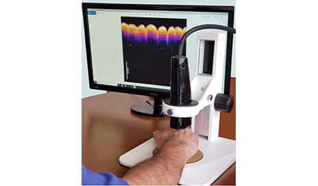 Rutgers Scientist Creates 'Virtual Biopsy' Device to Detect Skin Tumors ...