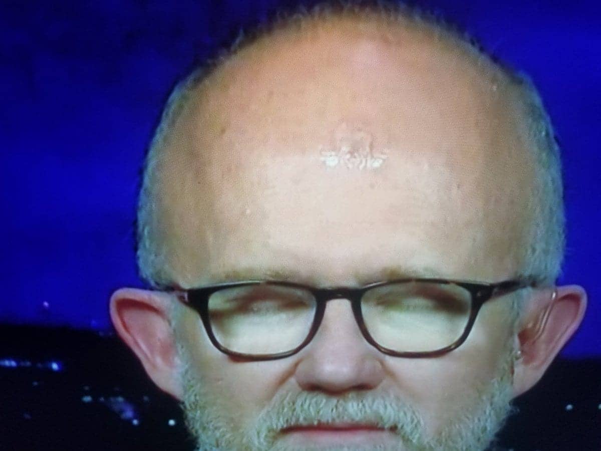 Rick Wilson Was Lucky His Skin Cancer Showed Up on High-Def Television ...