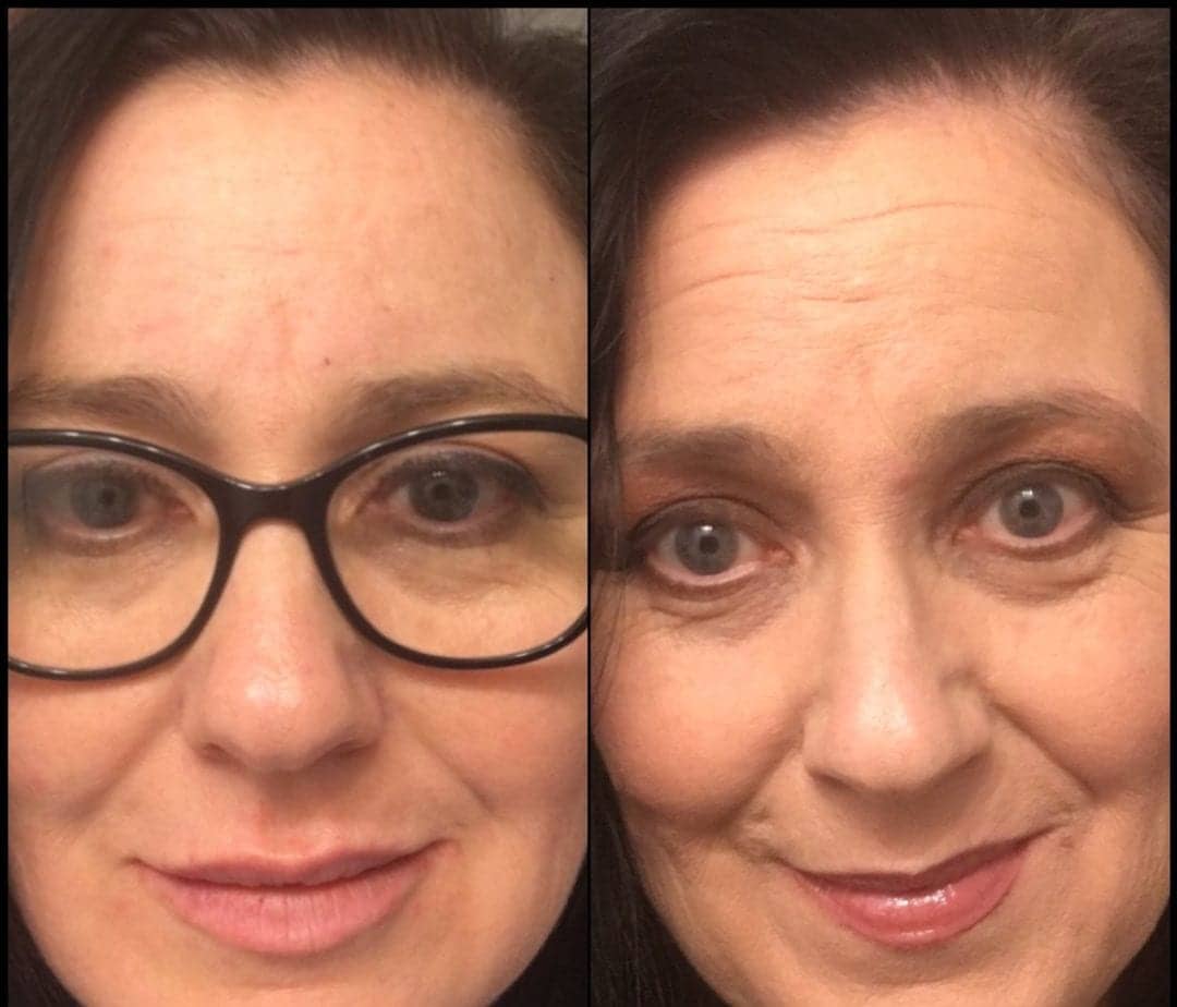 Theraderm Clinical Skin Care Study Shows 40% Reduction in Skin Laxity ...