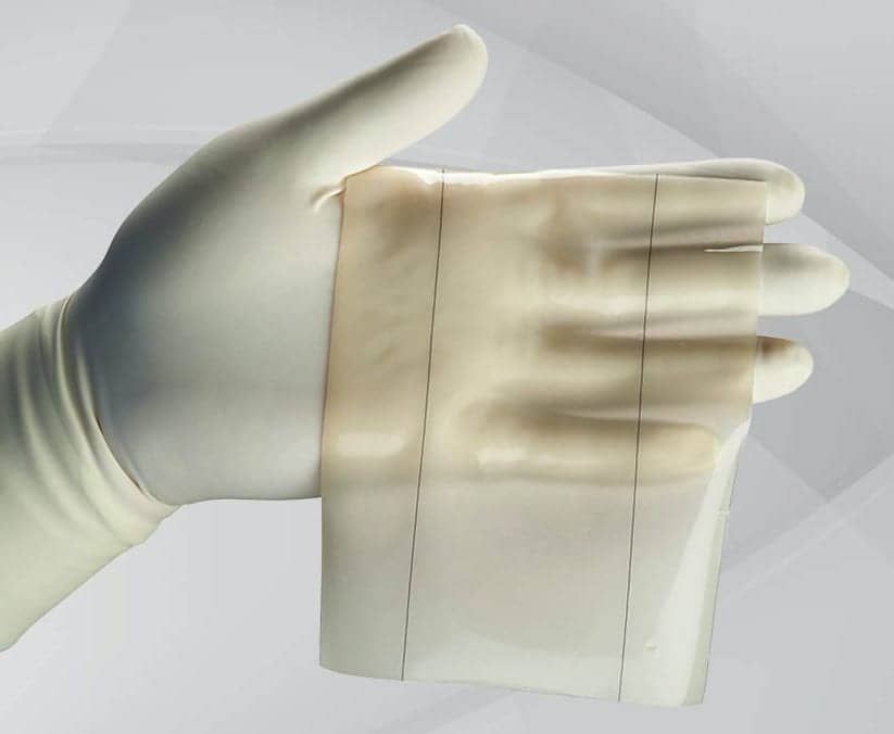 Integra LifeSciences Announces Positive Clinical Results for Integra ...