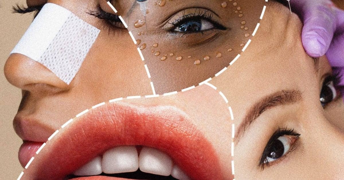 A Post-Quarantine Plastic Surgery Boom Is Happening - Plastic Surgery ...