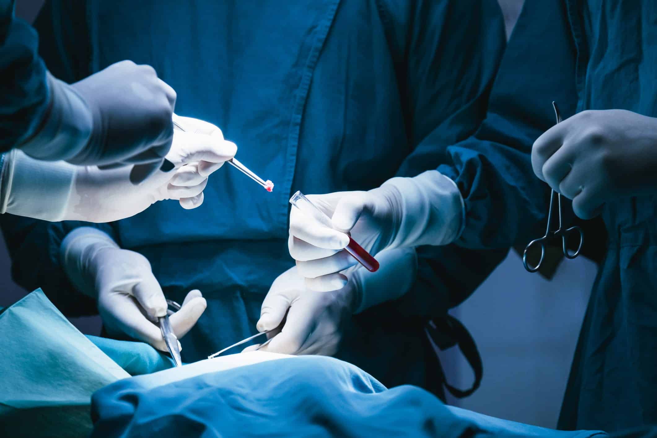 Long-Term Study Shows Positive Outcomes for Bioresorbable Breast ...